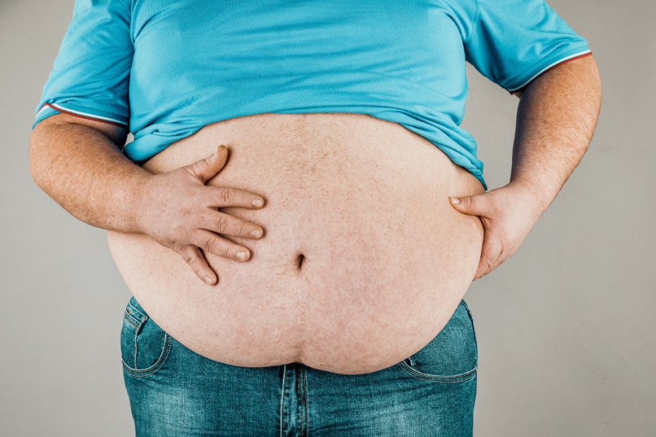 Comparative Effectiveness of Tirzepatide Versus Bariatric Surgery in ...